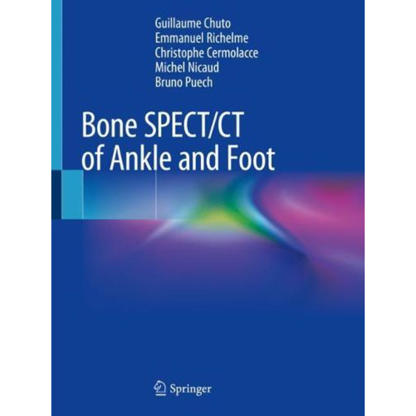 Skelett-SPECT/CT av fotled och fot | CDON