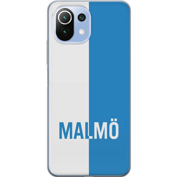 Kompatibelt Mobilskal till Xiaomi 11 Lite 5G NE Enkel blåvit design med ...